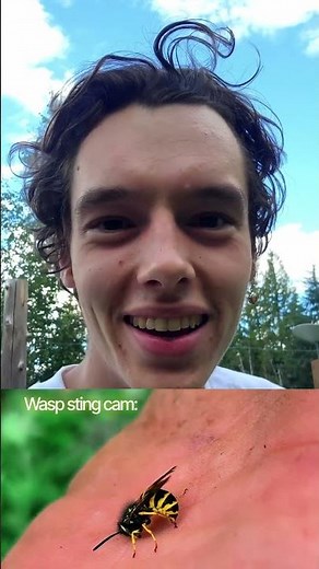 Why did I let a wasp sting me?
