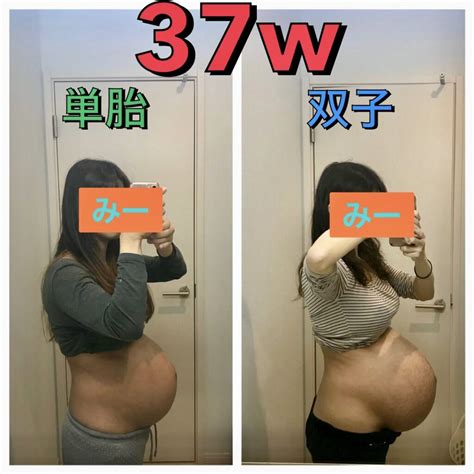 双子はお腹が出るのが早いって本当！？【実録】単胎との妊娠中のお腹の大きさ比較 双子のぎーちゃんドンさん子育てブログ