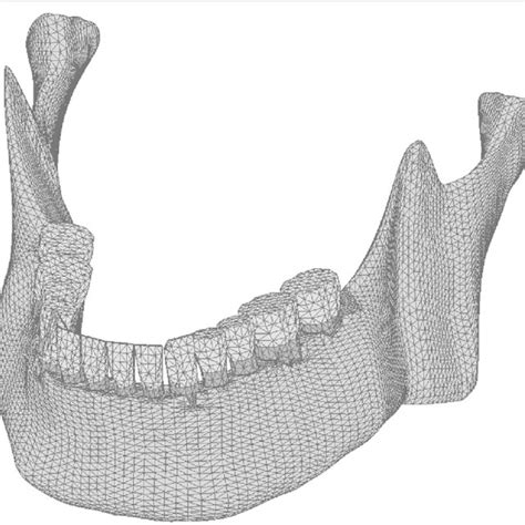 Three Dimensional Finite Element Model The Tooth Roots And Implant