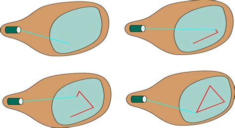 difference between random scan and raster scan display