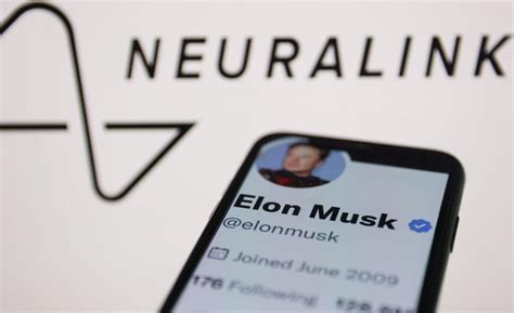 Neuralink Lo Que Hay Detrás De Implantes Cerebrales En Humanos Como El