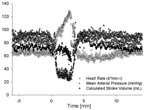 Figure 3 Hemodynamic Response To 45 Mmhg Lbnp For A Non Finisher A