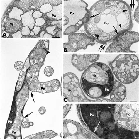 Scanning Electron Micrographs Of Pythium Oligandrum Hyphae Interacting