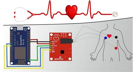 iot ecg monitoring with ad8232 ecg sensor and esp8266