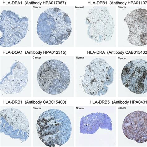 Validation Of Protein Expression Levels Of Hub Genes In The Hpa