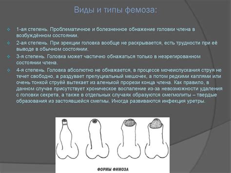 Виды Пениса Картинки Telegraph