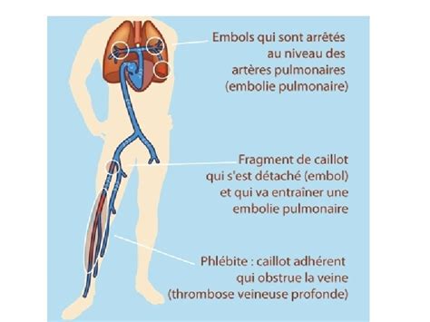 Les Troubles De La Circulation 2 Cours Danatomie