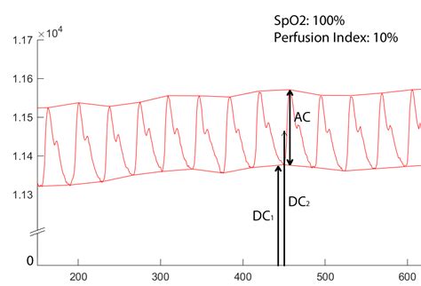 Matlab Calculate Spo₂ Value From Raw Fingertip Plethysmography Ppg