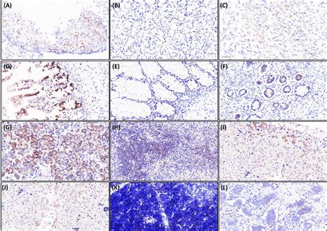 Rd3 In Situ Hybridization In Fetal Tissues Representative