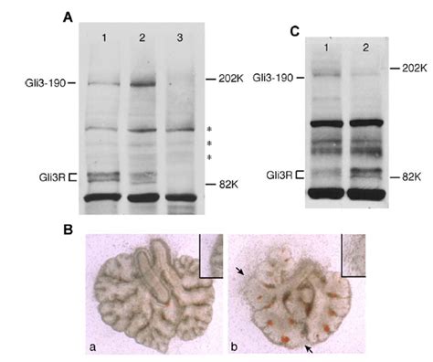 gli3 western blot gene expression assay gxd