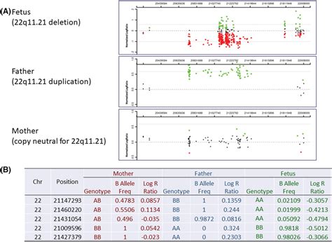 Chromosomal Microarray Plots Showing The Copy Number Status At 22q11 21