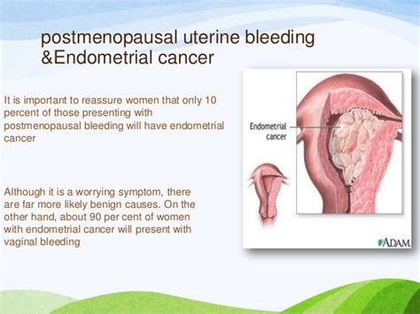 Postmenopausal Uterine Bleeding