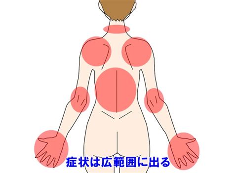 自覚がない肩こり隠れ肩こりの正体と症状や原因を解説 オーダーメイド枕の山田朱織枕研究所
