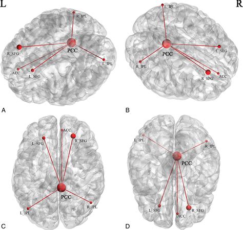 Resting State Functional Mri Everything That Nonexperts Have Always