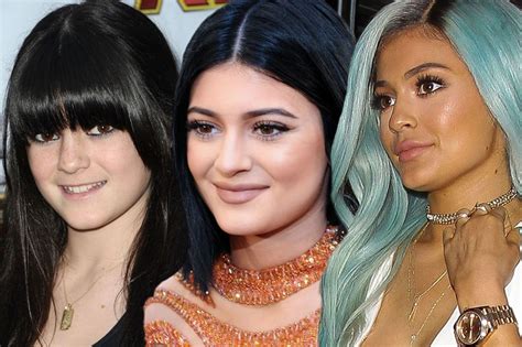 Kylie Jenner Has Aged Herself By A Decade After Fillers And Procedures