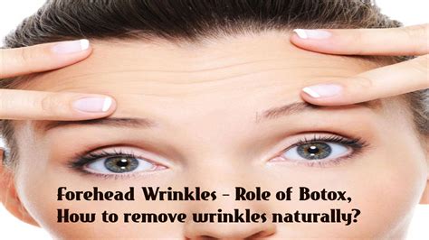 Forehead Wrinkles Role Of Botox How To Remove Wrinkles Naturally