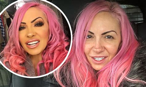 Jodie Marsh Unveils Difference In Before And After Snaps Daily Mail