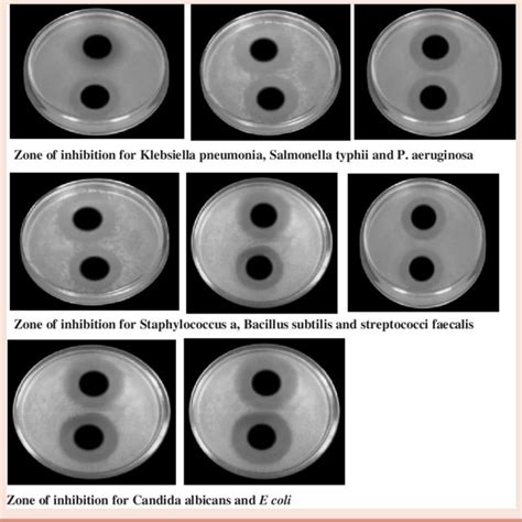 Photomicrographs Agar Plates Showing The Zone Of Inhibition Of
