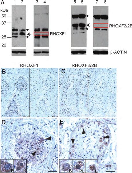 Cell Type Specific Expression Of Rhox Transcription Factors In Adult