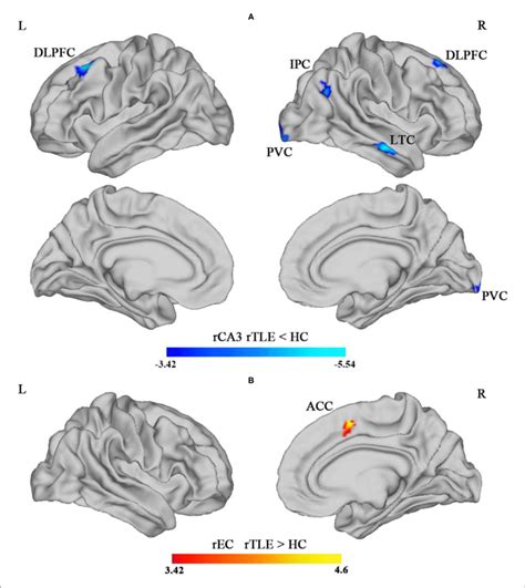 Intergroup Difference Of The Surface Based Functional Connectivity