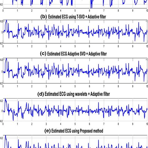 Estimated Ecg Signal Using Ecg Signal With Eas A T Svd Adaptive