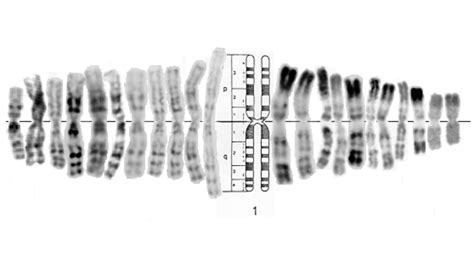 Chromosome Banding Pattern
