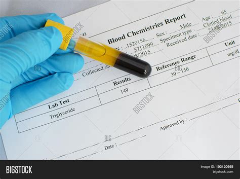 Triglyceride Result Image And Photo Free Trial Bigstock