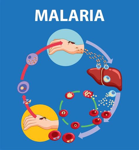 Ciclo De Vida Del Parásito De La Malaria Una Guía Visual Vector Gratis