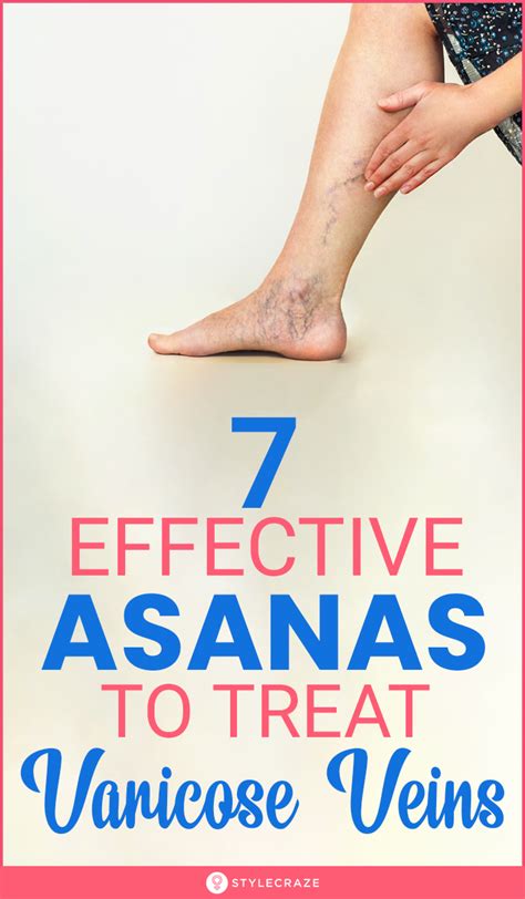 7 Effective Asanas To Treat Varicose Veins Artofit