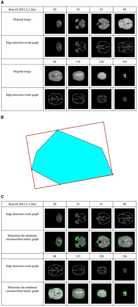 Frontiers Mmgan A Multimodal Mr Brain Tumor Image Segmentation Method