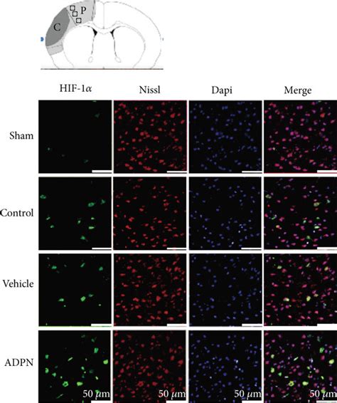 Adpn Enhanced The Proteins And Mrna Expression Of Hif 1α At 72 H After