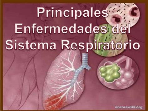 Enfermedades Del Sistema Respiratorio