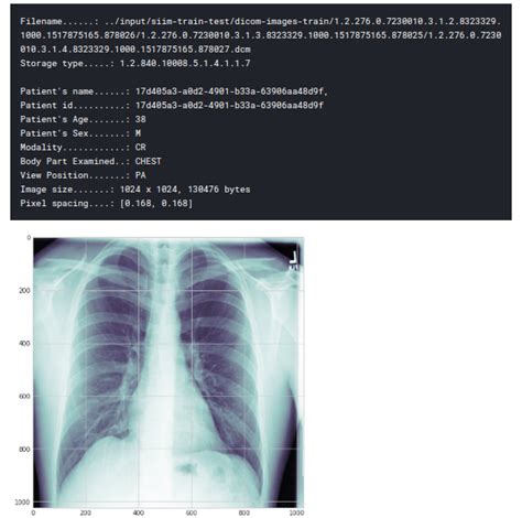 siim acr pneumothorax segmentation top 10 solution by