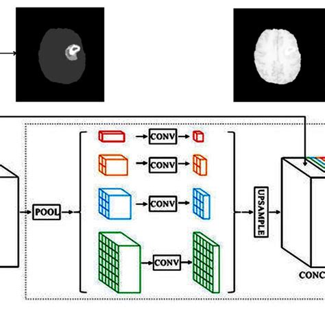 pdf hgg and lgg brain tumor segmentation in multi modal mri using