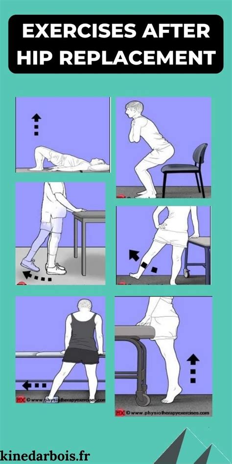 Physical Therapy After Hip Replacement Surgery Guide And Tips