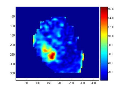 fingerprint recognition system based on matlab banana