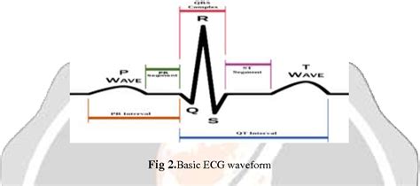 Figure 1 From A Review On Sleep Apnea Detection From Ecg Signal