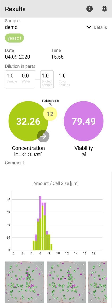 Interpreting The Results Of Oculyze Better Brewing App
