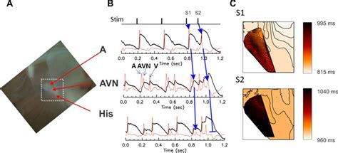 Frontiers Conduction Delays Across The Specialized Conduction System