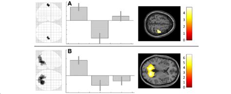 Polarity Dependent Effect Of Tdcs On Visual And Motor Processing