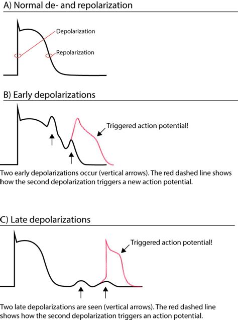 Figure 1 Late And Early Depolarizations Triggering Action Potentials