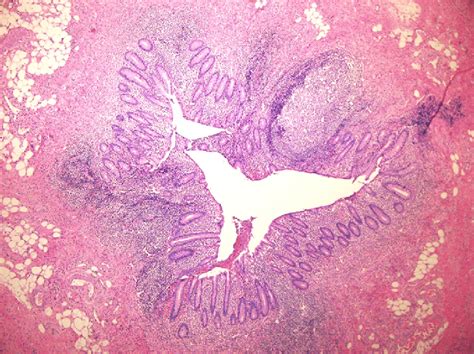 Normal Shaped Appendix Hande ×40 Download Scientific Diagram