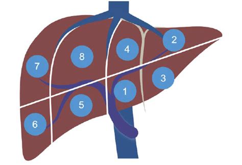 Abdominal Ct Liver • Litfl • Radiology Library