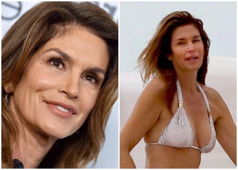Before And After Celebrity Plastic Surgery Images That Will Make Your