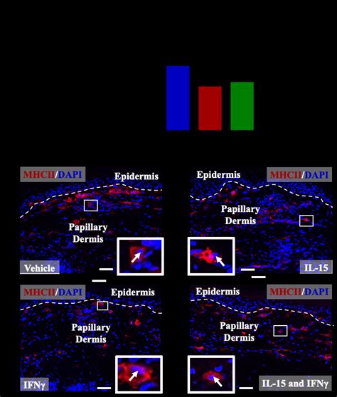Ifnγ Significantly Downregulates The Number Of Mhcii Cells In The