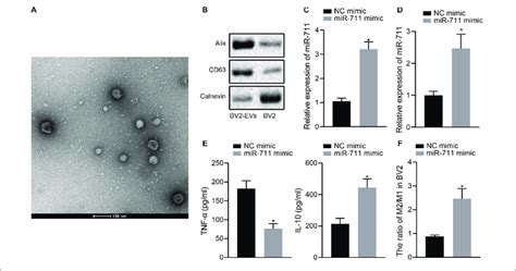Mir 711 Mediates The Anti Inflammatory Pathway And M2 Like Activation