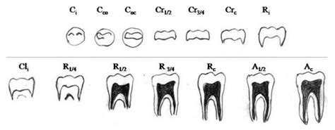 Computation Free Full Text Dental Age Estimation Using Deep