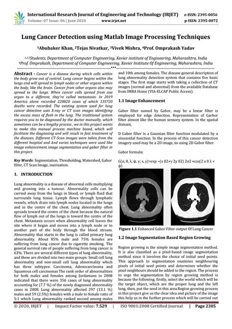 Irjet Lung Cancer Detection Using Matlab Image Processing Techniques