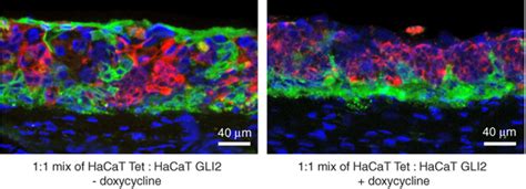 gli2 expressing cells grown in the presence of control