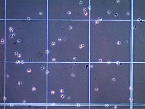 Counting Cells Using A Hemocytometer And Trypan Blue Teaching Biology